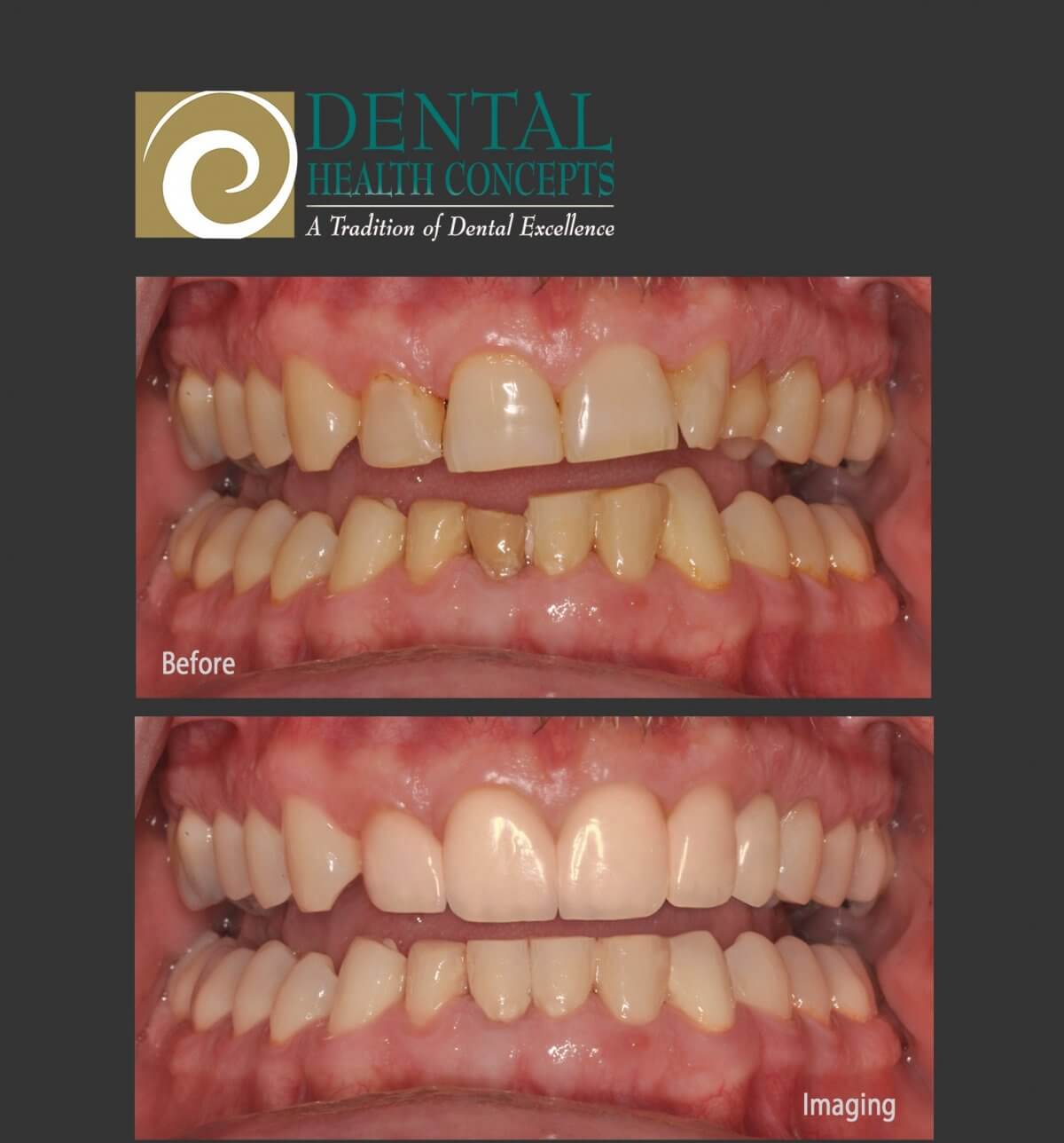 Dental Health Concepts | A Transformative Dental Case Study